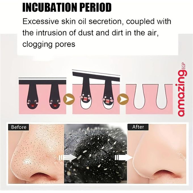 Deep Cleansing Nose Strips for Blackhead Removal, Natural